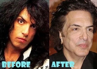 Paul Stanley's All Plastic Surgery Including Ear – Before and After ...