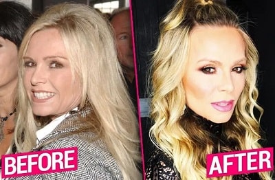 RHOC Star Tamra Judge’s Plastic Surgery and Tattoos – Before and After ...