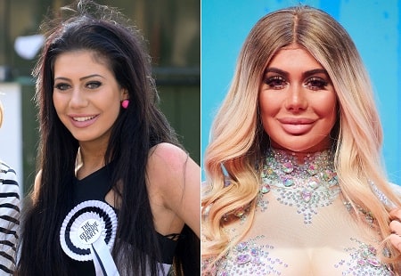 Chloe Ferry Plastic Surgery - 10 Obvious Modifications On Geordie Shore ...